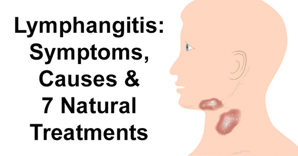 Lymphangitis: Symptoms, Causes & 7 Natural Treatments - David Wolfe Shop