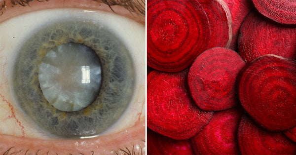 Beets: 10 Health Benefits - David Wolfe Shop