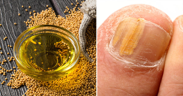Mustard Essential Oil: 10 Health Uses - David Wolfe Shop