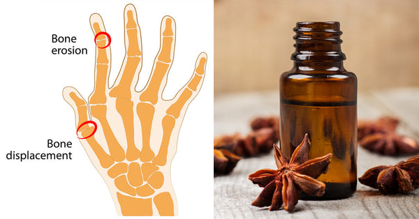 Anise Essential Oil: 10 Health Benefits - David Wolfe Shop