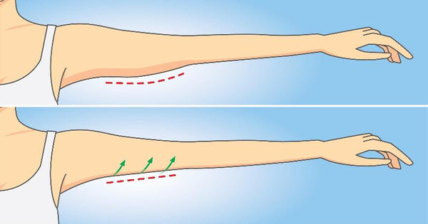 3 Simple Ways to Reduce Stubborn Arm Fat! - David Wolfe Shop