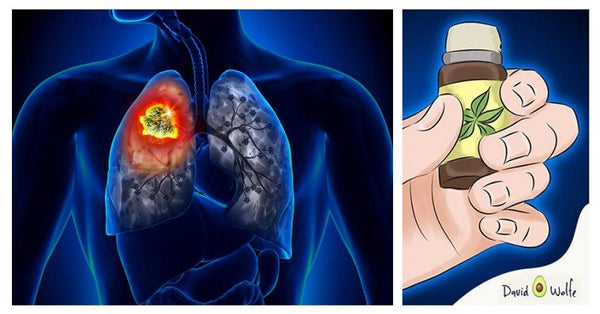 The Truth About Cancer And Essential Oils: What Oncologists Won't Tell ...