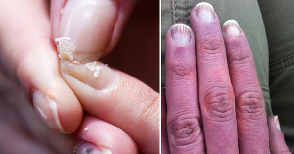 6 Things Your Hands Say About Your Health - David Wolfe Shop