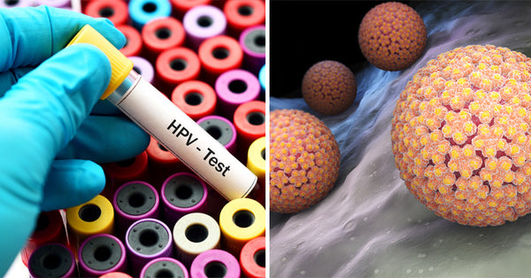 HPV Treatment: Causes, Symptoms & 4 Natural Treatments - David Wolfe Shop