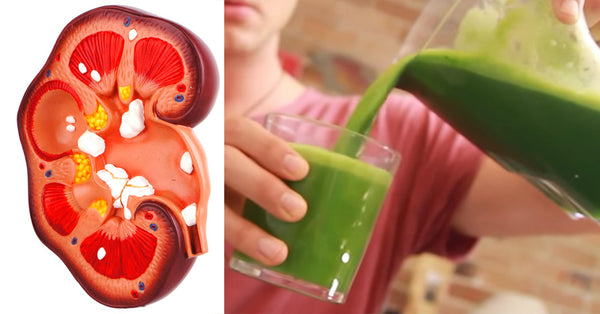 This Drink Will DETOX Your Kidneys and Body Fast! - David Wolfe Shop