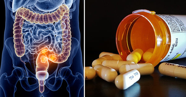 This Common Medication Is Linked To Bowel Cancer - David Wolfe Shop