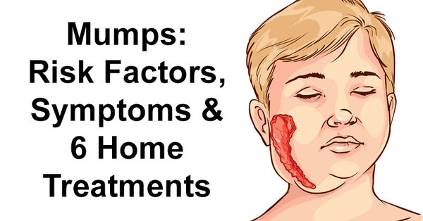 Mumps: Risk Factors, Symptoms & 6 Home Treatments - David Wolfe Shop