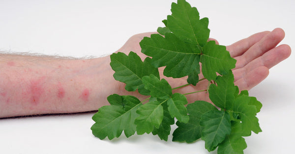 Poison Oak Treatment: Symptoms & 5 Natural Treatments - David Wolfe Shop