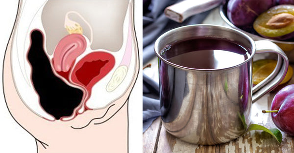 Prune Juice Benefits: More Than Just A Natural Constipation Reliever ...